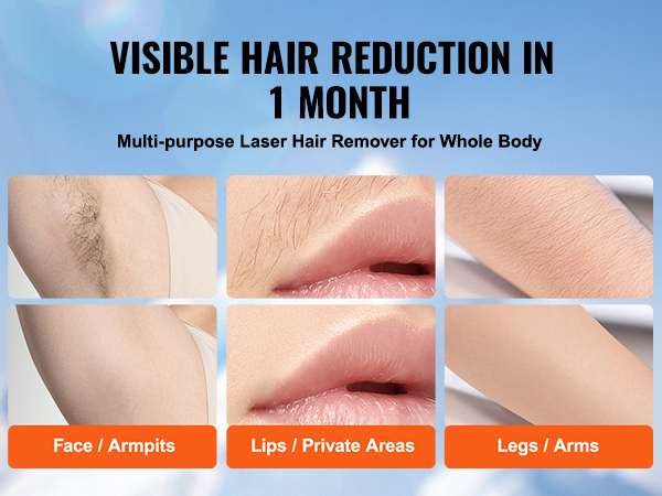 VEVOR IPL Hair Removal, Permanent Hair Removal with Ice Cooling System ...